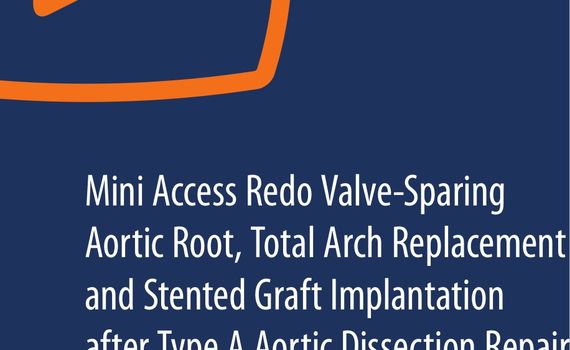 Mini Access Redo Valve-Sparing Aortic Root, Total Arch Replacement and ...