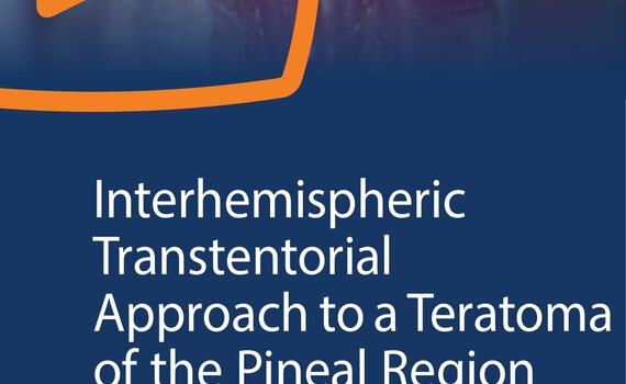 Interhemispheric Transtentorial Approach To A Teratoma Of The Pineal ...