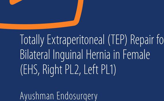 Totally Extraperitoneal (TEP) Repair for Bilateral Inguinal Hernia in ...