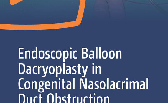 Endoscopic Balloon Dacryoplasty in Congenital Nasolacrimal Duct ...