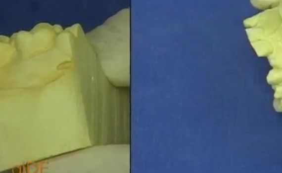 Step-by-Step Radiographic and Surgical Guide Splint Manufacturing ...