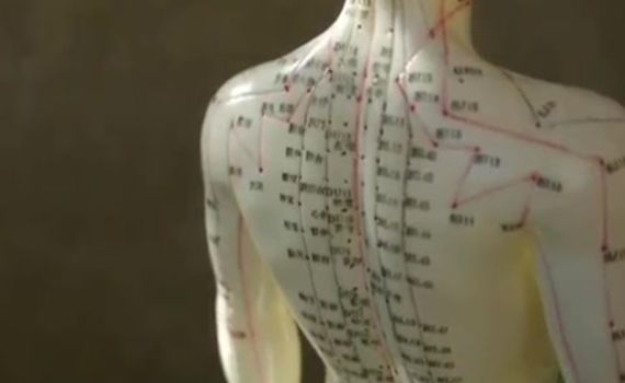 The Art Of Acupuncture And How It Works - Alexander Street, a ProQuest ...
