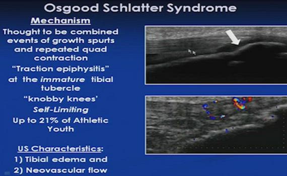 Musculoskeletal Ultrasound Imaging: Lower Extremity Pathology ...