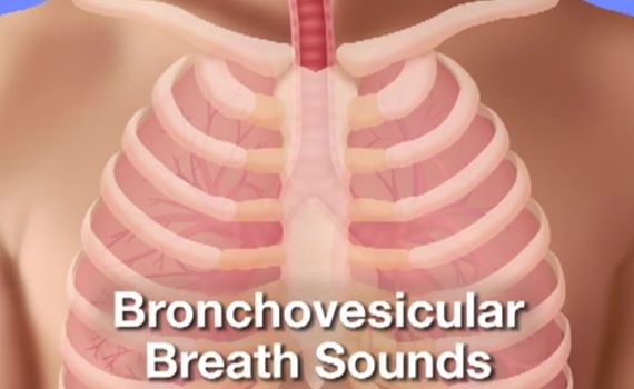 Auscultation of breath sounds: Assessing bronchovesicular breath sounds ...